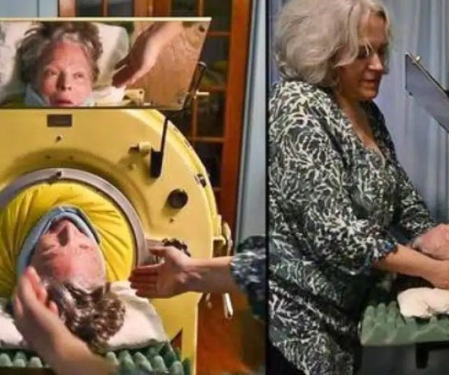 Notícias | Mulher que usou pulmão de aço para sobreviver contou sua ...